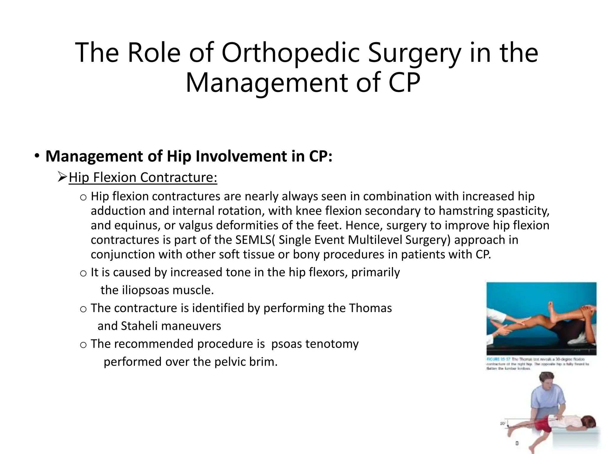Cerebral palsy in orthopaedics..2..pptx