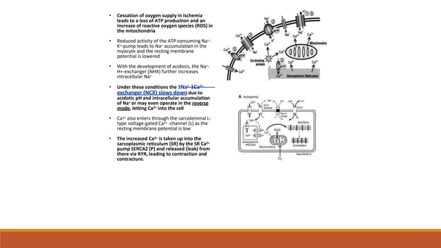 REPERFUSION INJURY---------------------- | PPTX | First Aid | Injuries