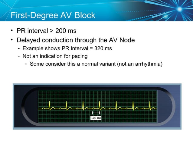 CP1-Bradyarrhythmias-and-Pacemaker-Indications-2012.ppt