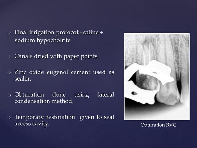 manegment of intraoral sinus in single sitting endodontics | PPT