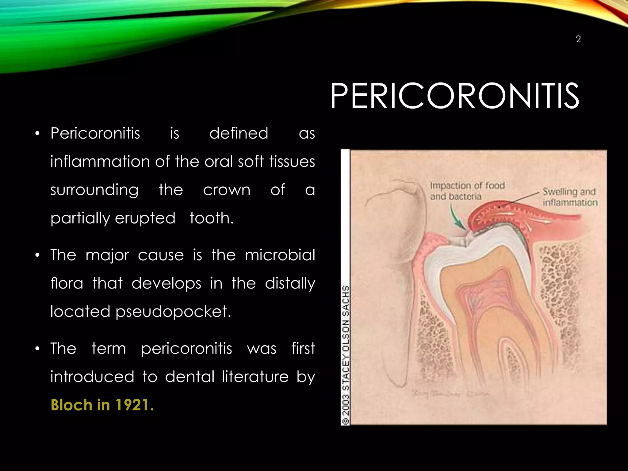 Pericoronitis | PPTX