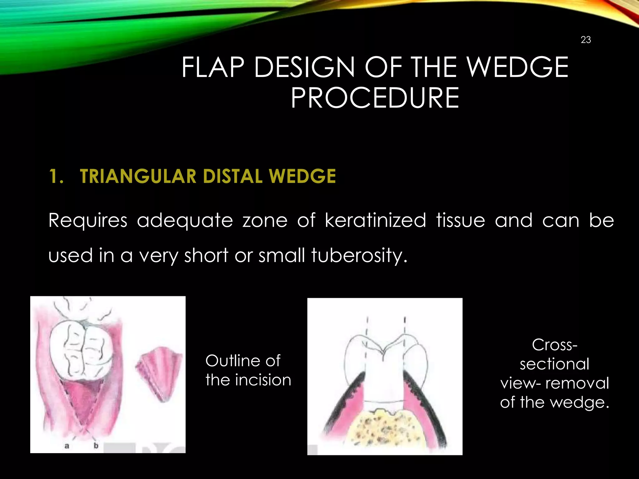 Pericoronitis | PPTX