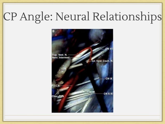CP angle.pptx | Brain and Nervous System Disorders | Diseases and Conditions