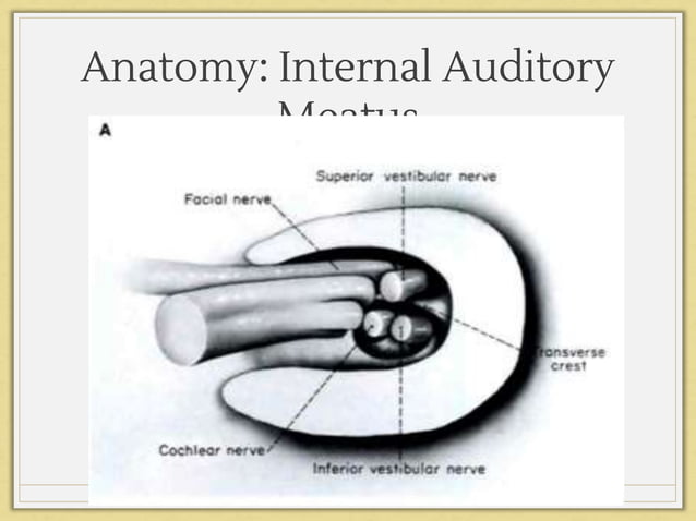 CP angle.pptx | Brain and Nervous System Disorders | Diseases and ...