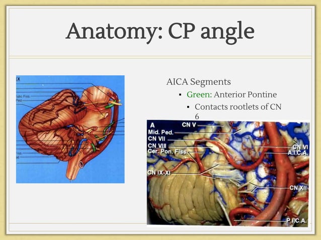 CP angle.pptx | Brain and Nervous System Disorders | Diseases and Conditions