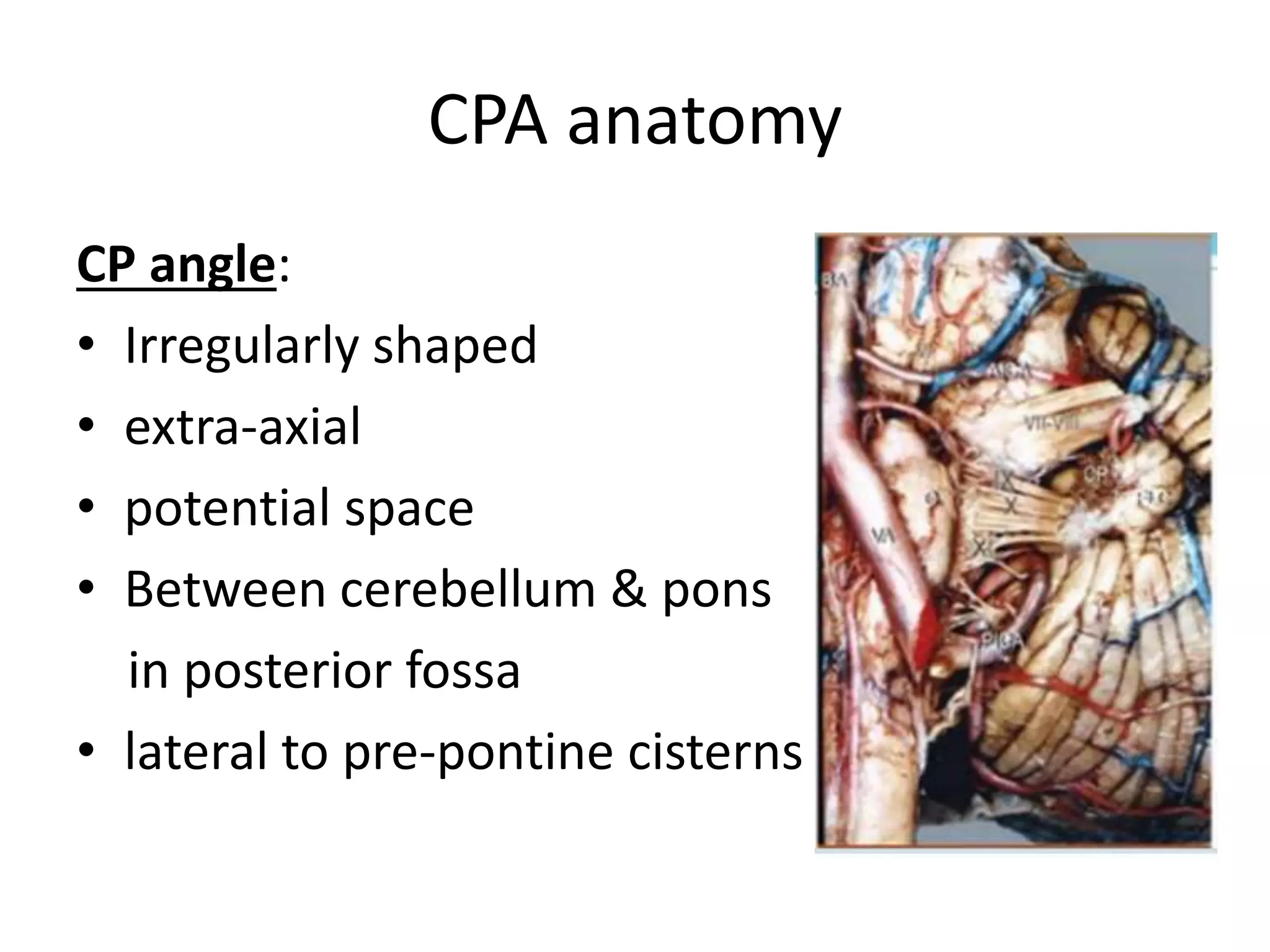 CP ANGLE TUMOR.pptx | Ear, Nose and Throat Conditions | Diseases and Conditions