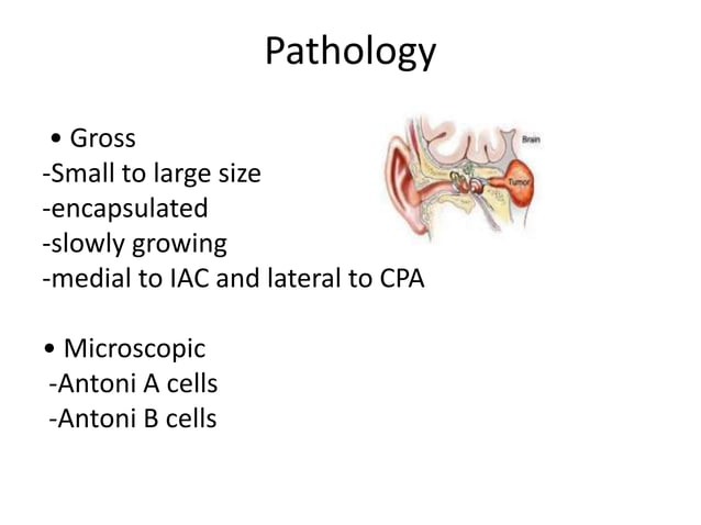 CP ANGLE TUMOR.pptx | Ear, Nose and Throat Conditions | Diseases and ...