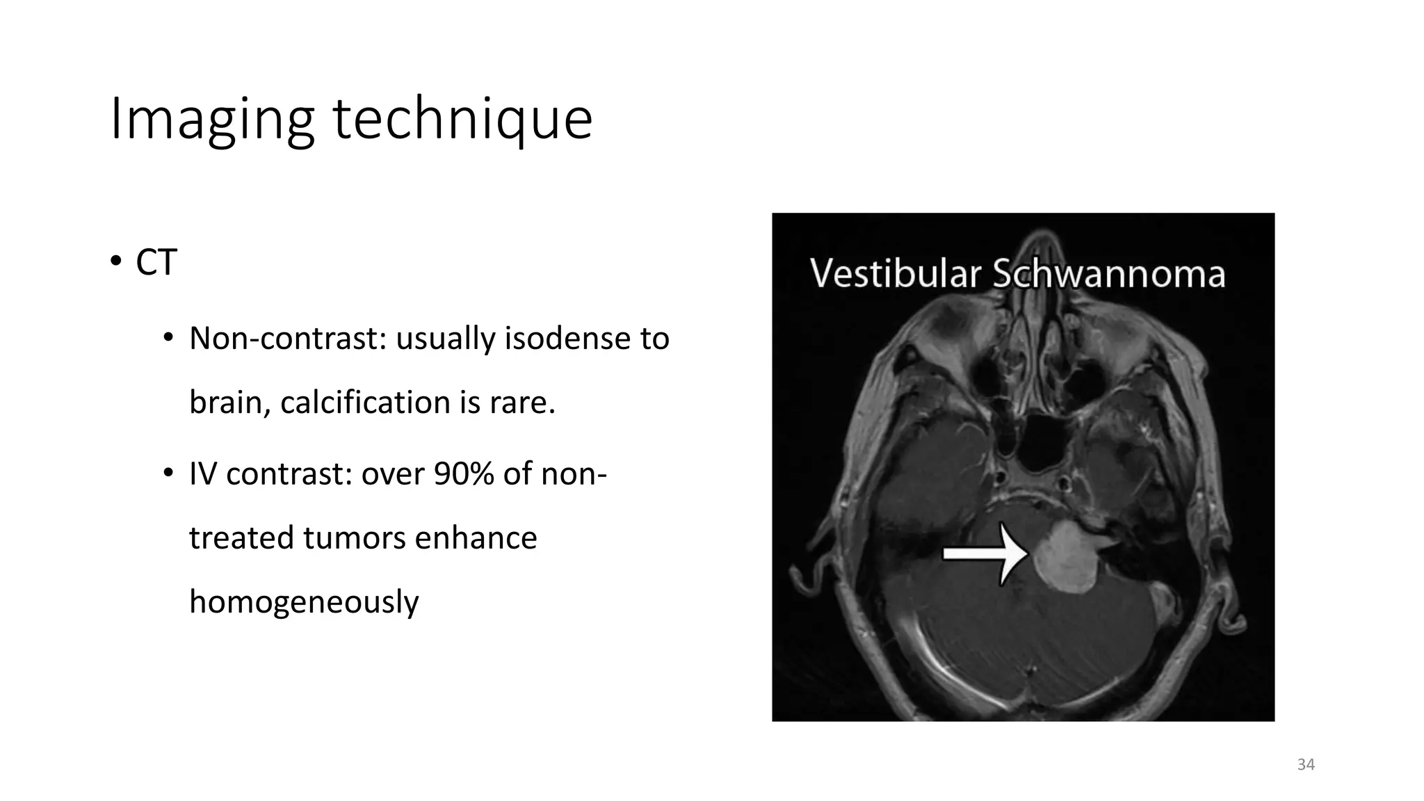 CP Angle Tumors (Vestibular Schwannoma) | PPTX