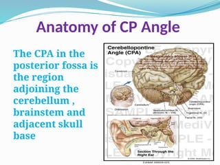 CP Angle Tumors in neurosurgery aspect .pptx
