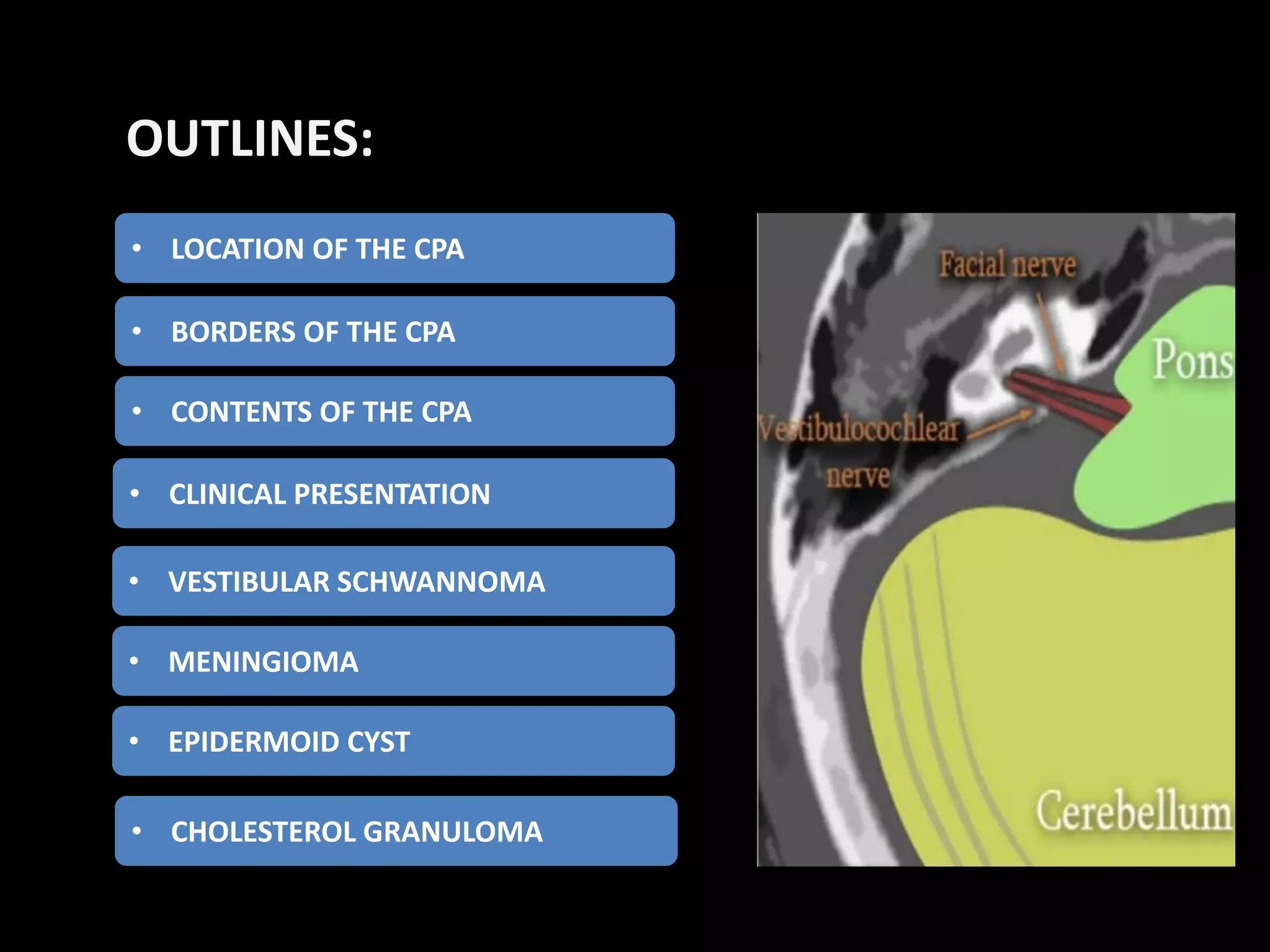 Cp angle tumours | PPTX
