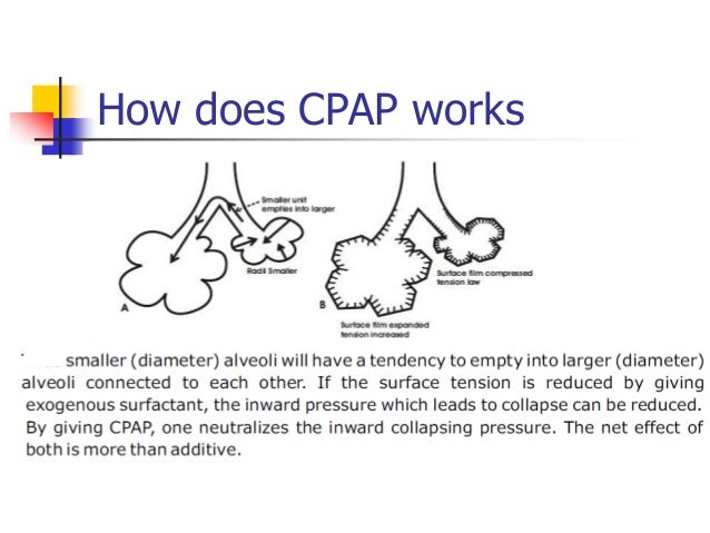 Cpap