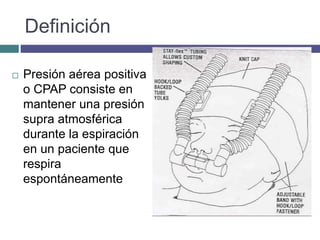 Cpap | PPTX