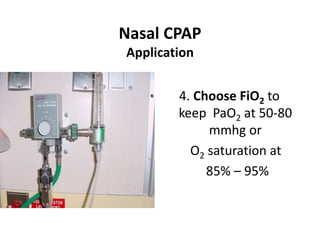 Cpap | PPTX