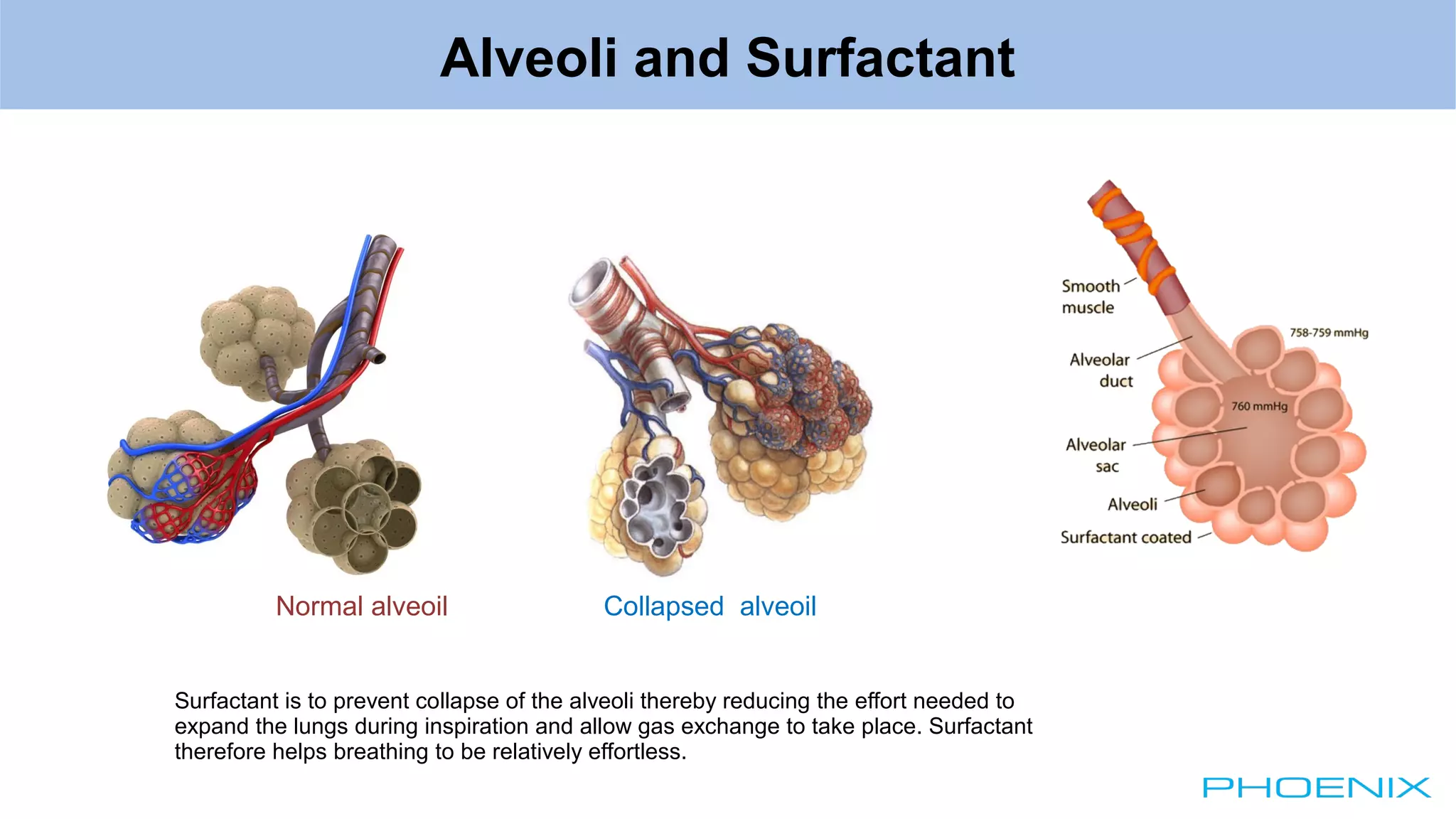 Nasal CPAP Unit 300 | PPT