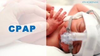 Nasal CPAP Unit 300 | PPT