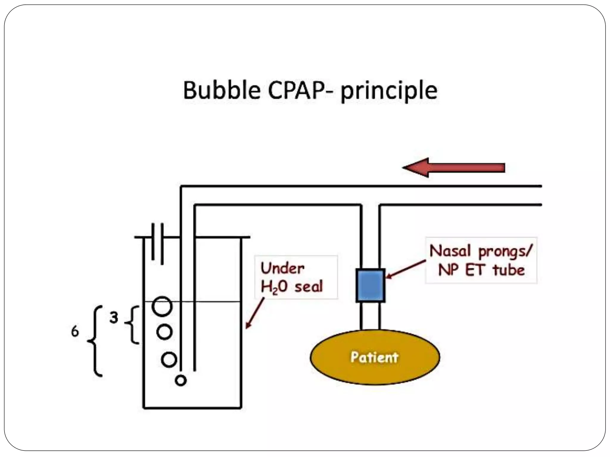 BUBBLE CPAP: NEW BORN | PPTX