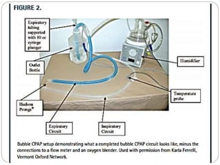 BUBBLE CPAP: NEW BORN | PPTX
