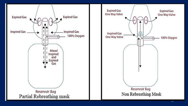 CPAP,.pptx neonatal non invasive ventilation | PPT