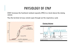 cpap-final in neonatal care respiratory .pptx
