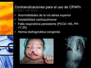 Cpap nasal | PPTX
