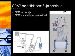 Cpap nasal | PPTX