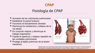 CPAP Nasal presentación de pasos y fisiologia | PPTX