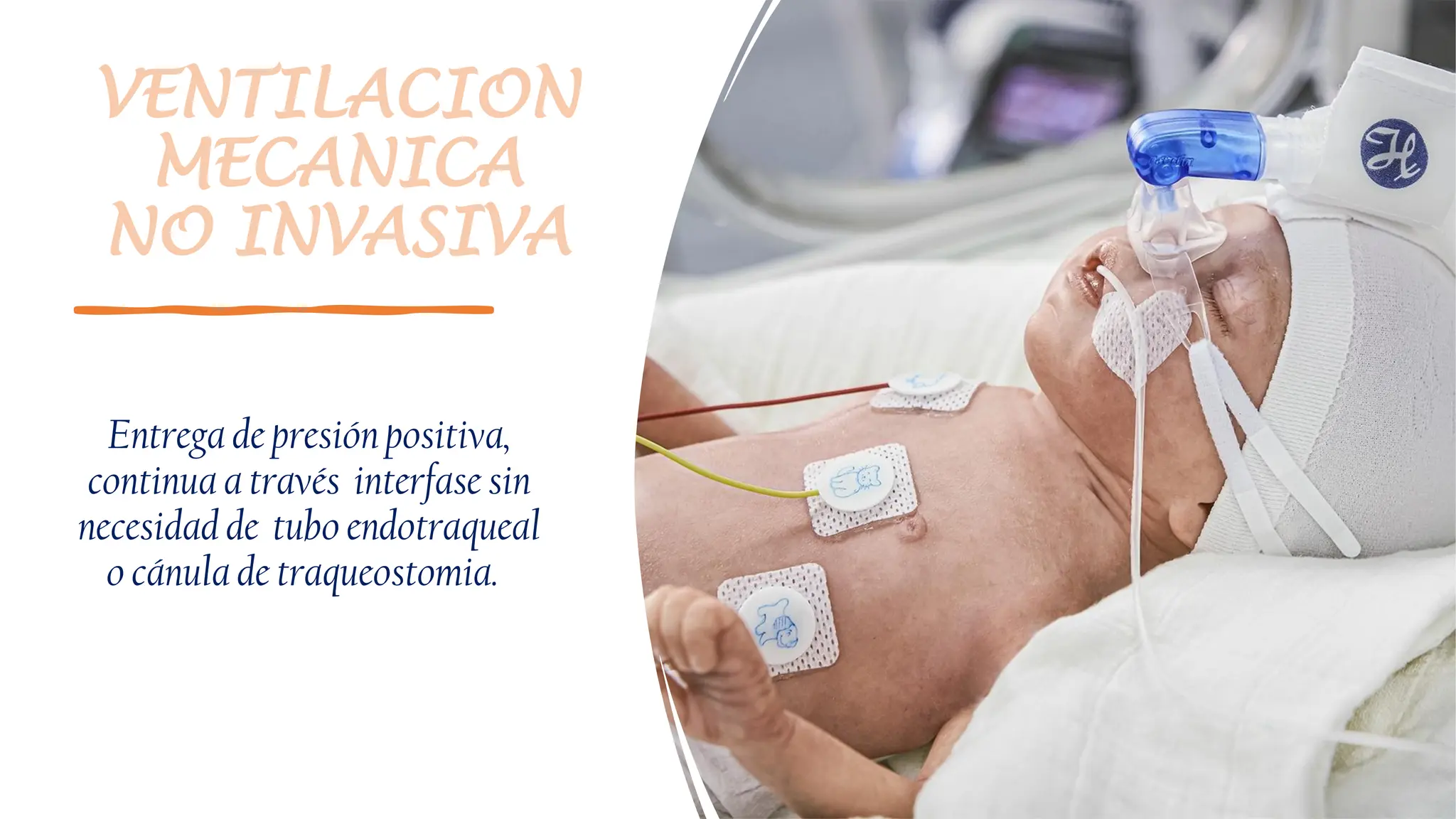 CPAP NEONATAL, usos , fisiopatologia e indicaciones | PPTX
