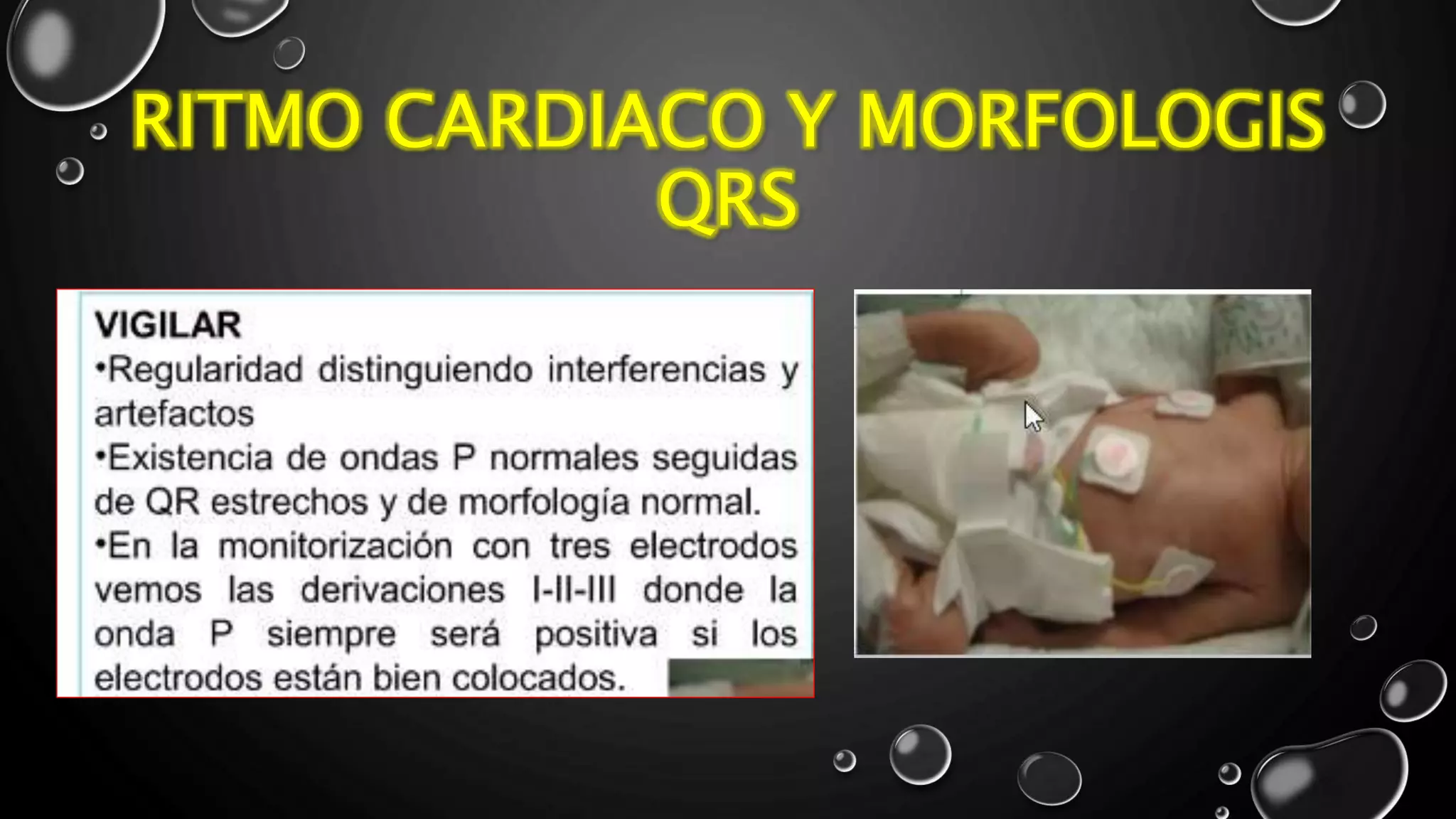 CPAP, VENTILACION MECANICA, MONITORIIZACION DE SV EN NEONATOS | PPT