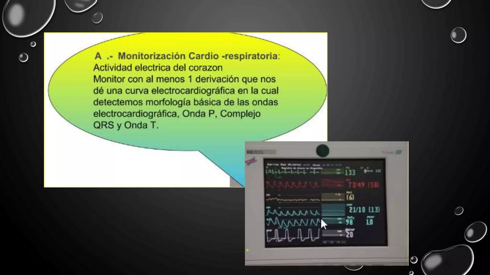 CPAP, VENTILACION MECANICA, MONITORIIZACION DE SV EN NEONATOS | PPT