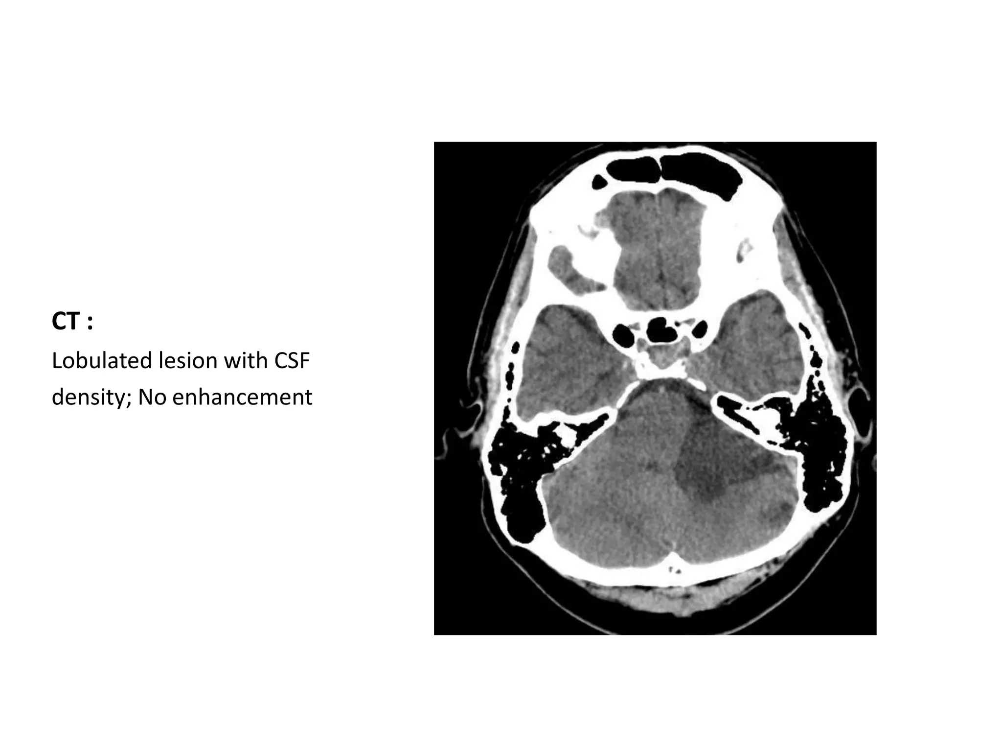 Cpa sol radio discussion | PPTX