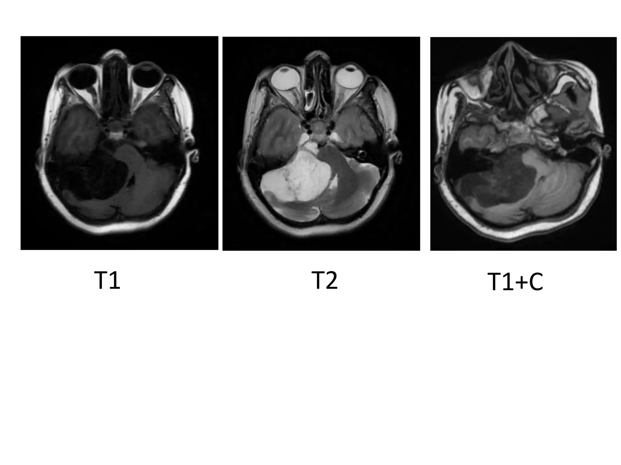Cpa sol radio discussion | PPT