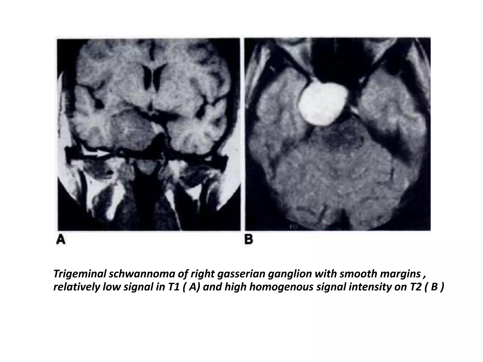 Cpa sol radio discussion | PPTX