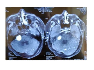 Cpa sol radio discussion | PPT