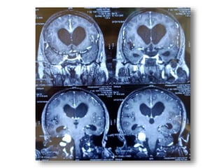 Cpa sol radio discussion | PPT