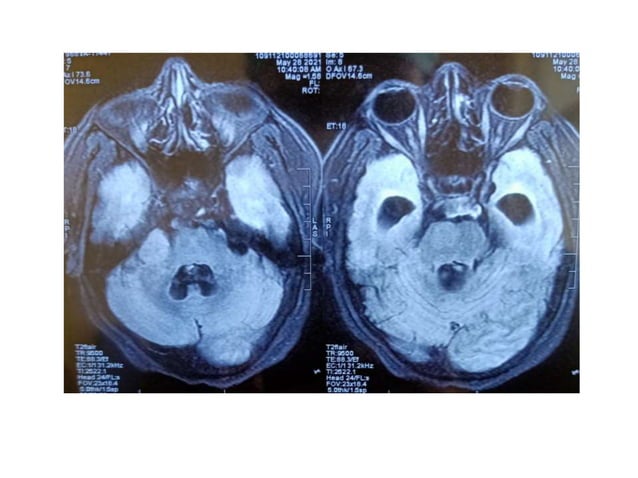 Cpa sol radio discussion | PPT