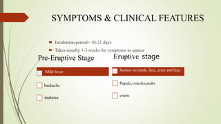 Chickenpox: Pathophysiology | PPTX