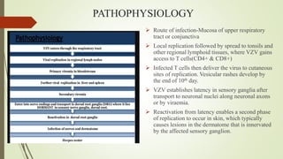 Chickenpox: Pathophysiology | PPTX