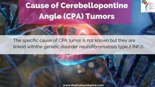 Cerebellopontine angle (CPA) tumors - An Overview | PDF
