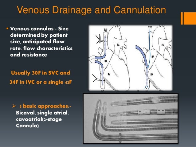 Cardiopulmonary Bypass