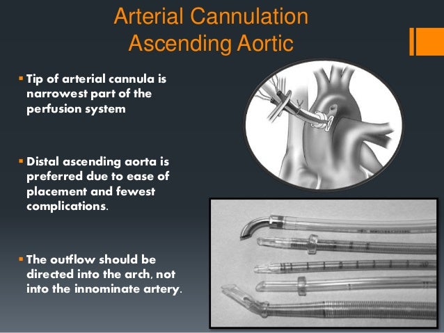 Cardiopulmonary Bypass