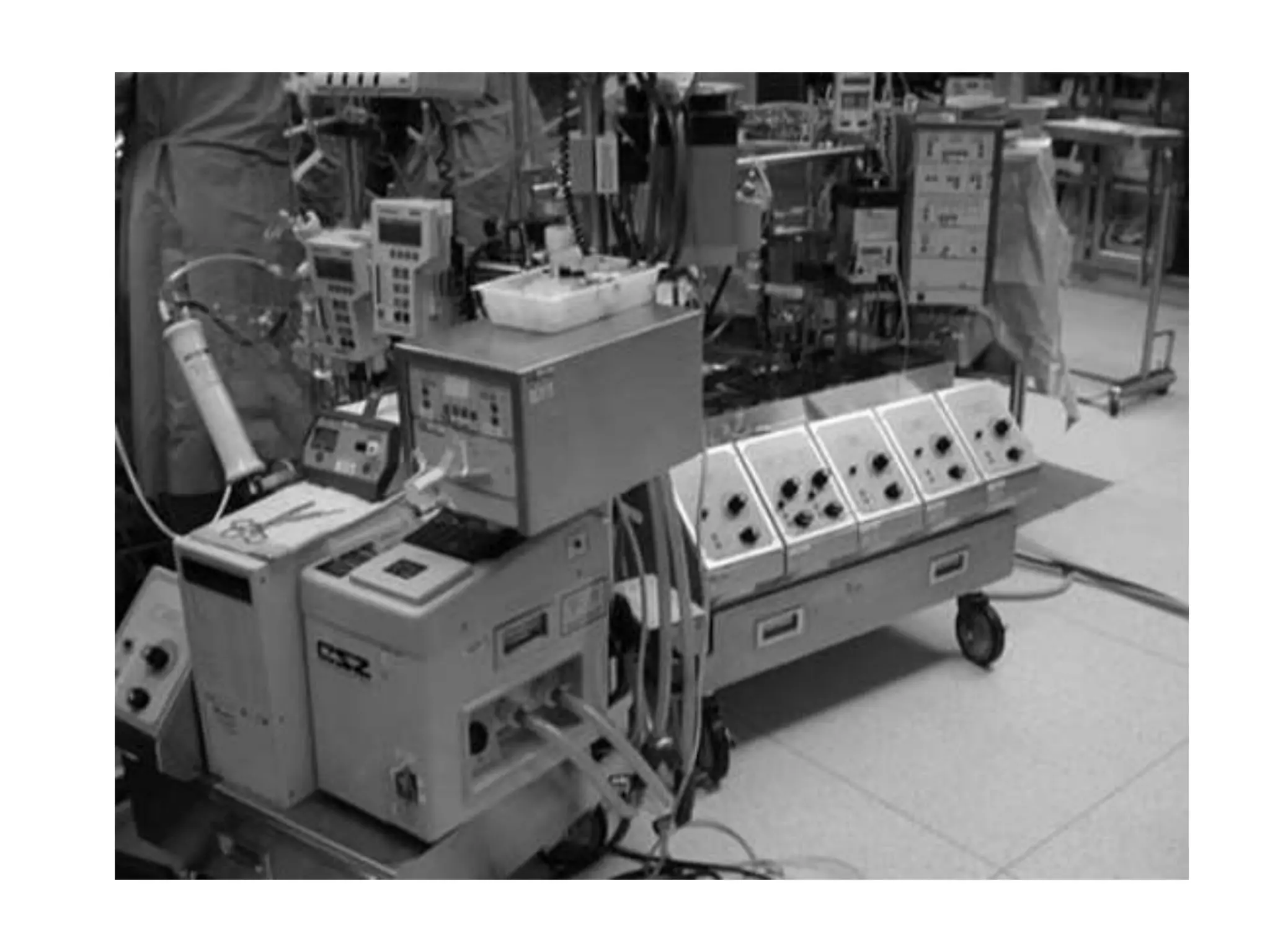 CPB on ECMO pt.pptx | Heart and Cardiovascular Diseases | Diseases and ...