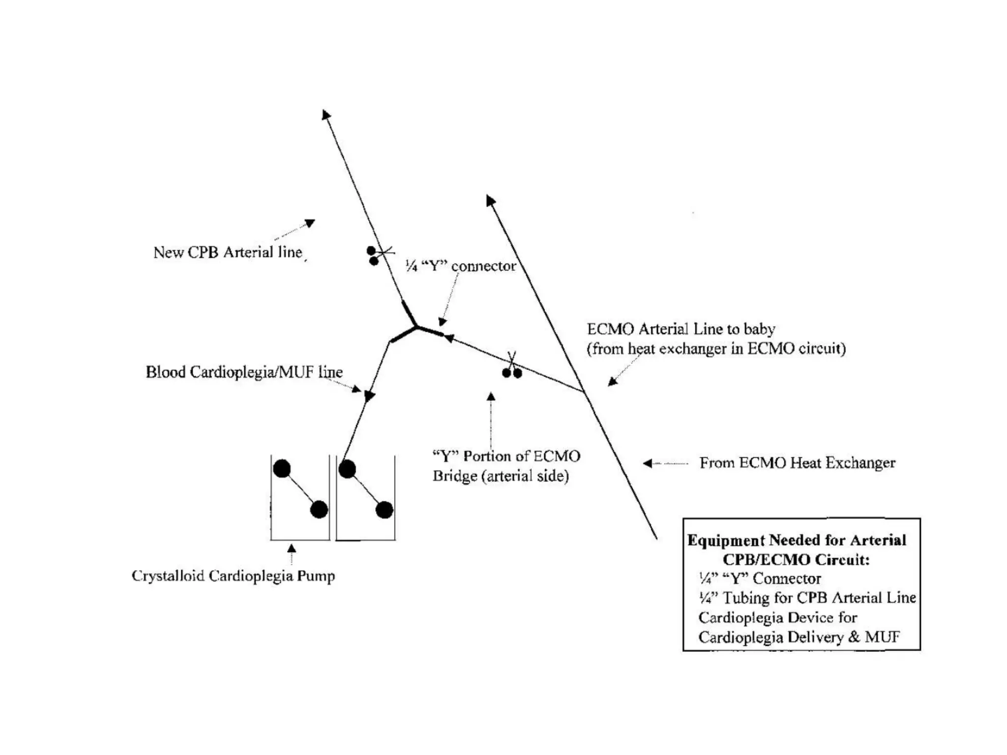CPB on ECMO pt.pptx | Heart and Cardiovascular Diseases | Diseases and ...