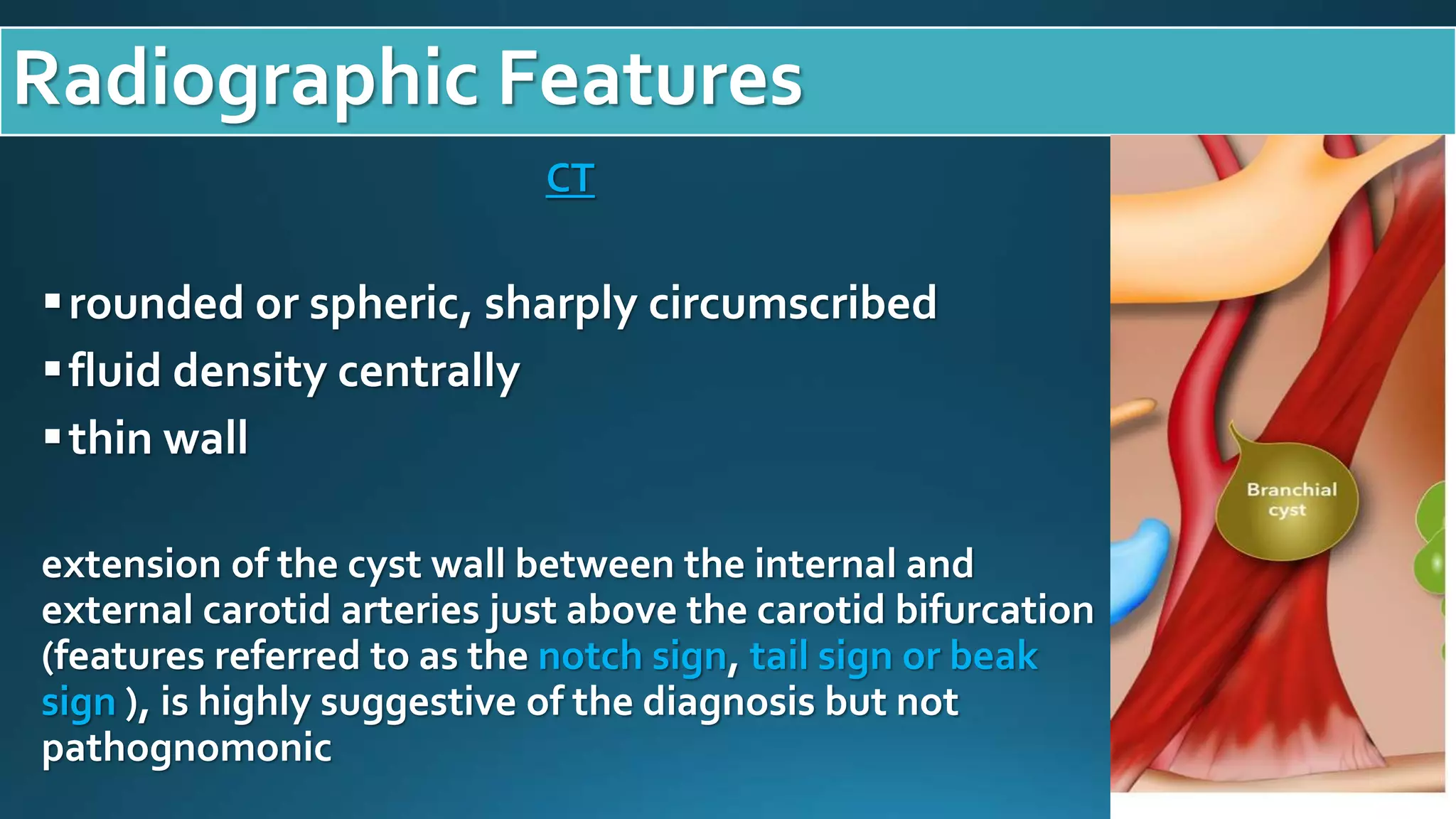 Case Presentation Branchial Cyst | PPTX