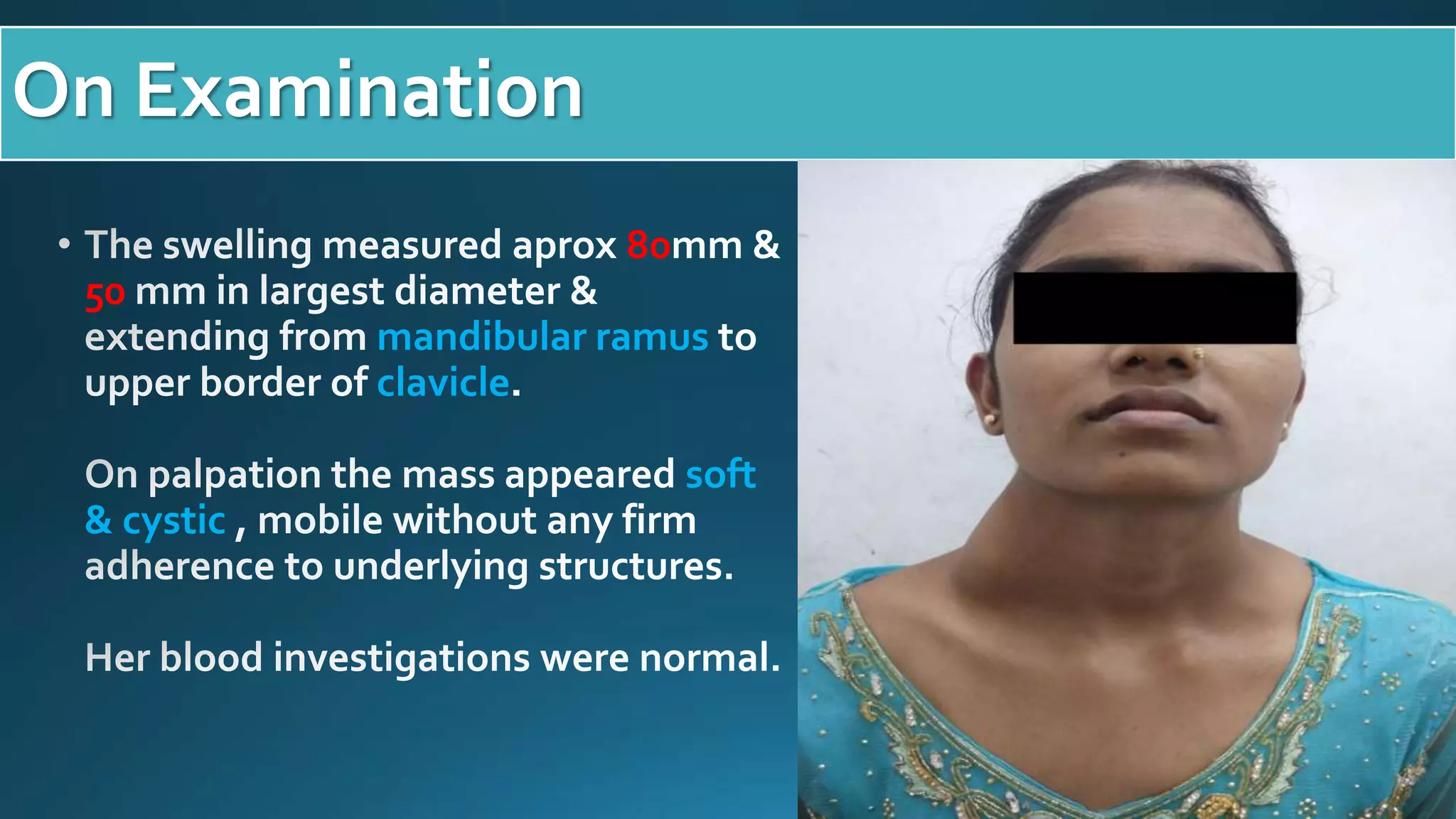 Case Presentation Branchial Cyst | PPTX