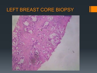 MDT conference case | PPTX