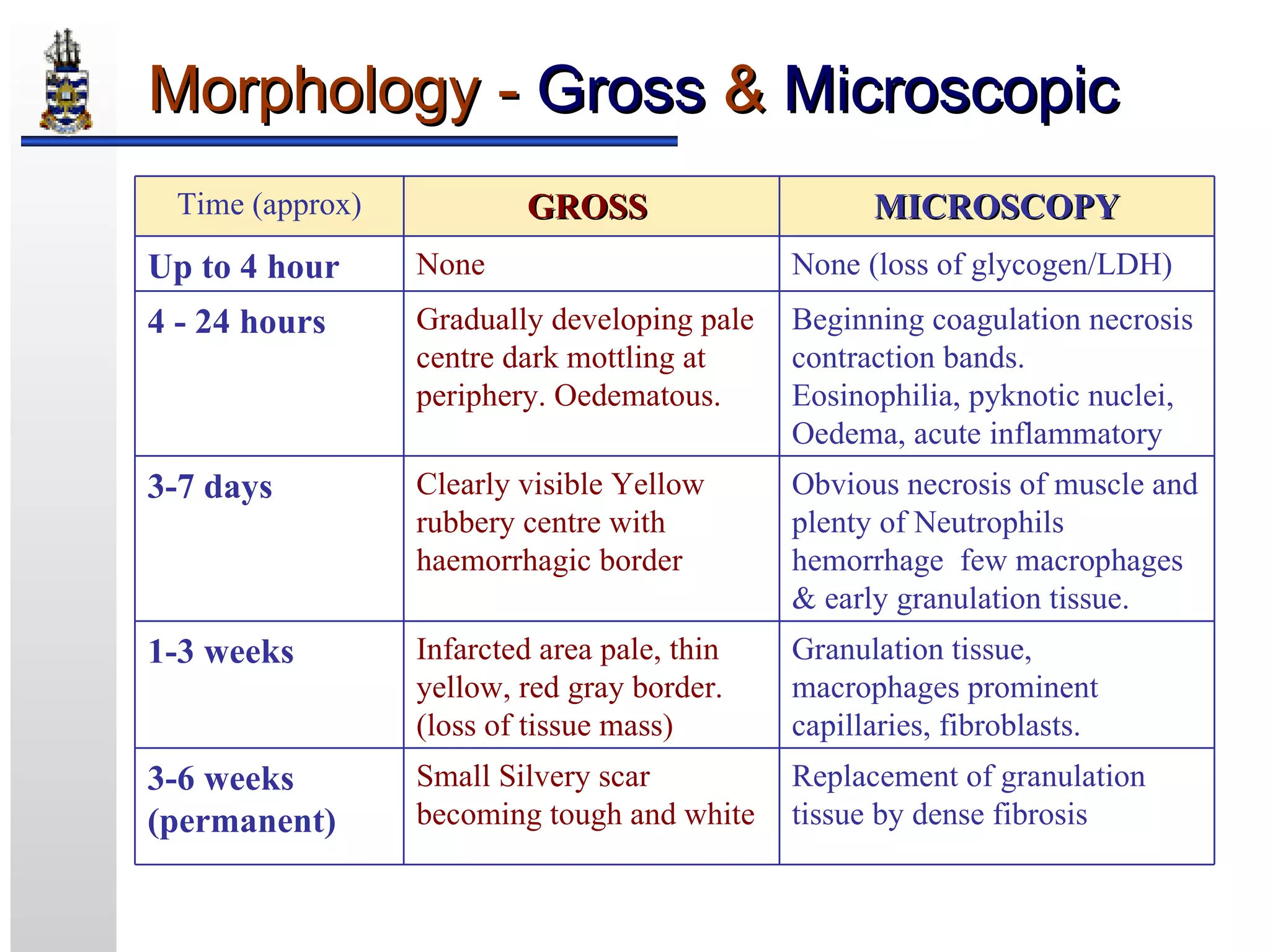 Pathology of Myocardial Infarction | PPT