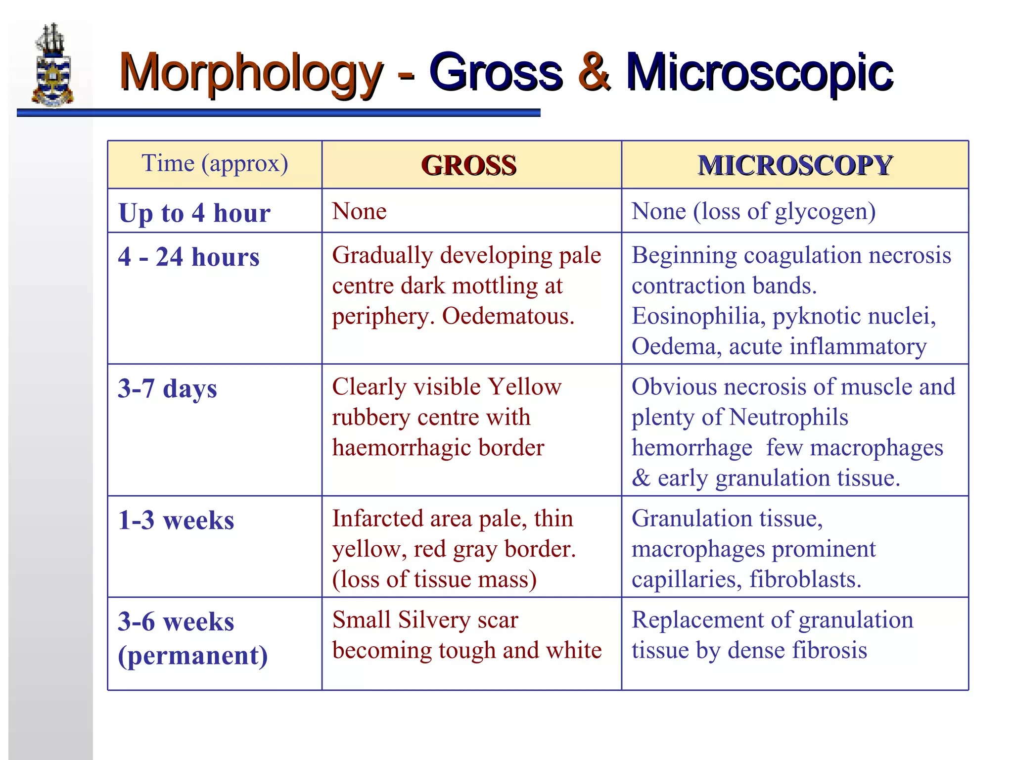 Pathology of Myocardial Infarction | PPT