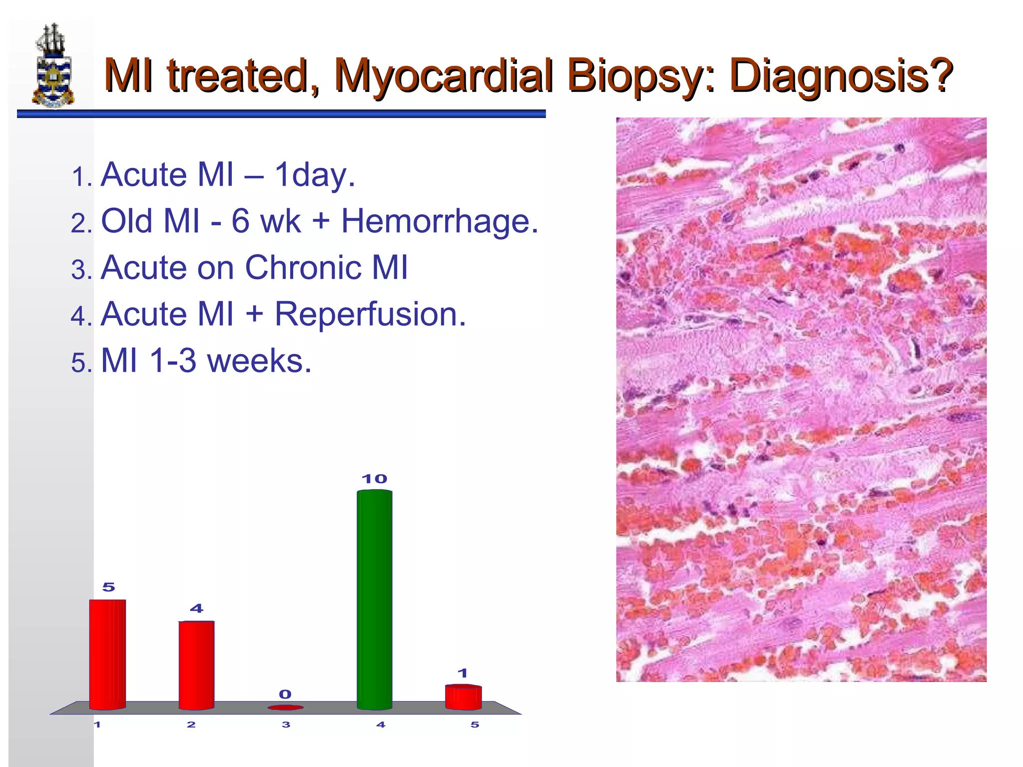 Pathology of Myocardial Infarction | PPT