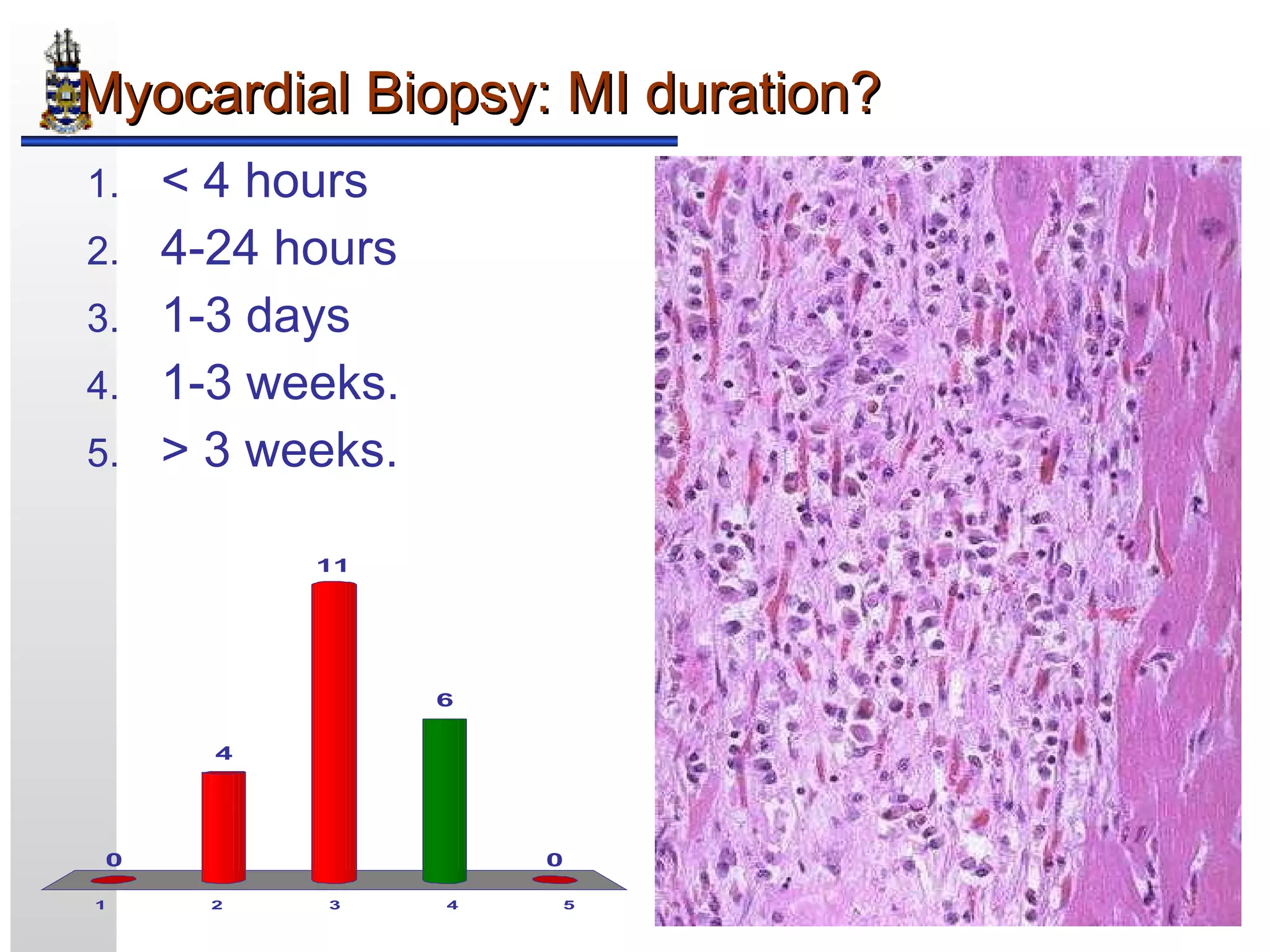 Pathology of Myocardial Infarction | PPT