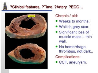 Pathology of Myocardial Infarction | PPT